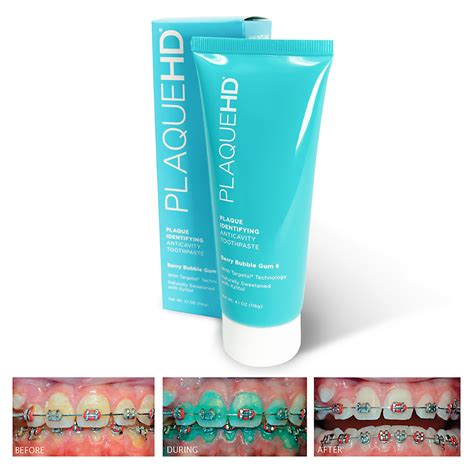 Plaquehd Toothpaste Ortho Technology