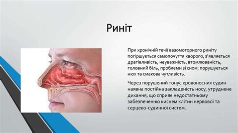 Ураження нервової системи при захворюваннях дихальних шляхів