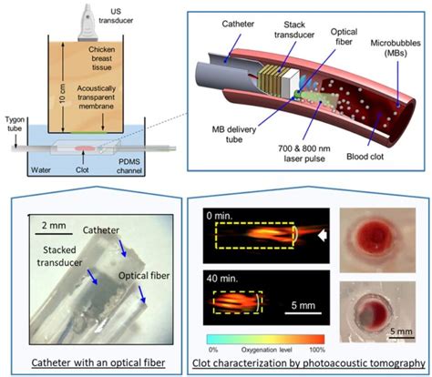 Miniaturized Stacked Transducer For Intravascular Sonothrombolysis With Internal Illumination