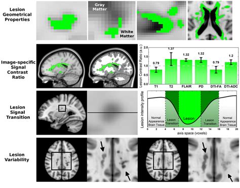 Lesion Modeling Used In The Entire Simulation Process Lesion