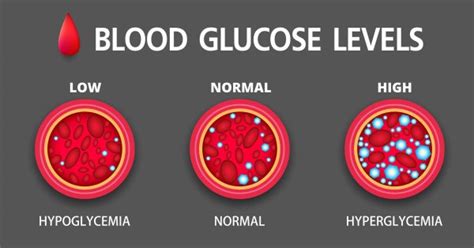 Как да понижите кръвната захар без лекарства Az Jenata