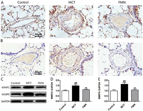 Fmn Suppresses Mct Induced Increases In Expression Levels Of Mmps