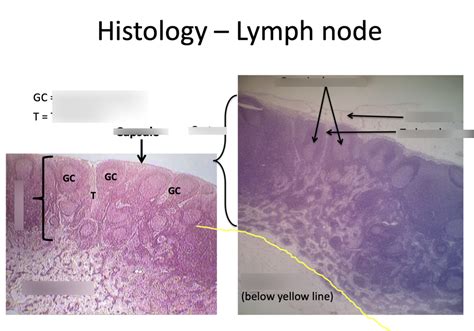 Bsc 216 Lab Exam 2 Histology Lymph Node Diagram Quizlet