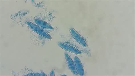 32 Macroconidia Microsporum Gypseum Youtube