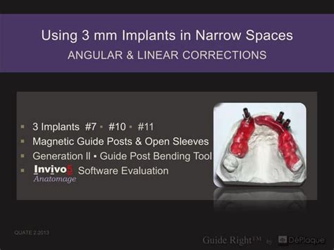 10 3 Mm Implants In Narrow Space Angular And Linear Corrections Ppt