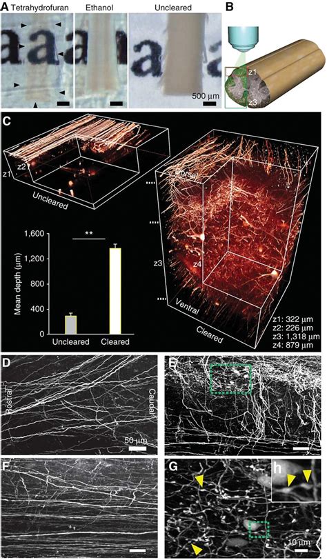 Clearance Allows High Resolution Imaging Of The Unsectioned Spinal