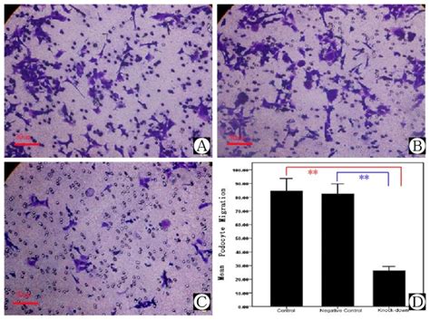 A Podocyte Migration In Control Group B Podocyte Migration In Download Scientific Diagram