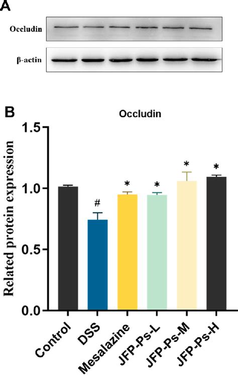 Figure 1 From Polysaccharide From Artocarpus Heterophyllus Lam