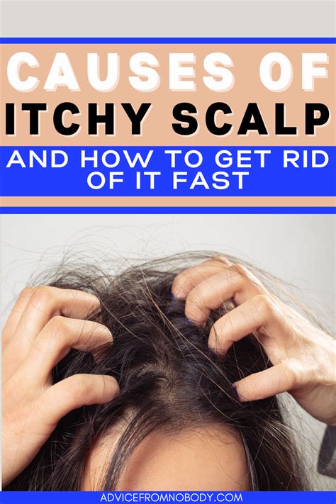How To Stop Your Scalp From Itching And The Reasons Why Its Happening In 2025 Itchy Scalp