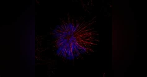 Structured Illumination Microscope Helps Iu Researchers To Better