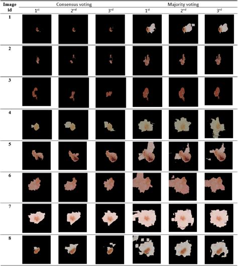 Figure 4 From Ensemble Based Genetic Algorithm Explainer With Automized