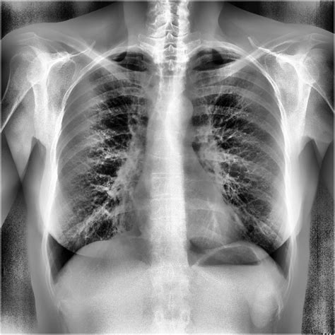 Clahe Lacks Support For Other Image Types · Issue 4770 · Opencvopencv