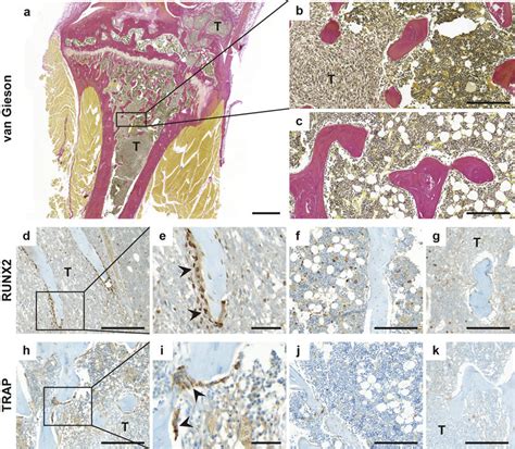 Increased Bone Remodeling Activity In Rat Tibia After Tumor Cell Download Scientific Diagram