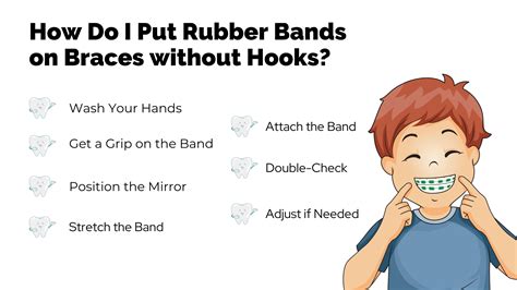 What Are The Hooks On Braces For