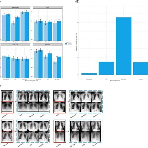Results On The Chest X Ray Datasets A Performance Of Adapted And Download Scientific Diagram