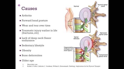 Cervical Os During Menses
