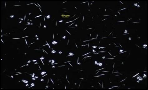 polarized light microscopy crystals