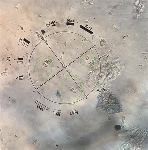 Microscopic Mold Spore Identification Rmycology
