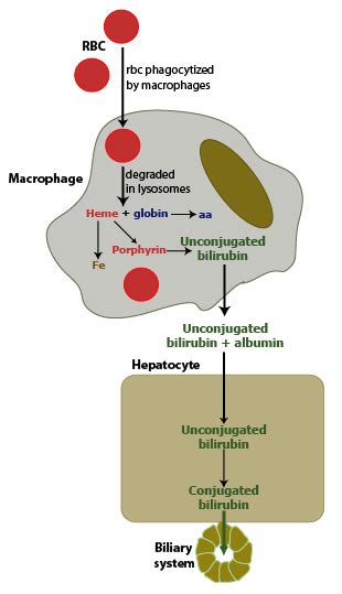 Production Of Bilirubin With Hemolysis Eclinpath