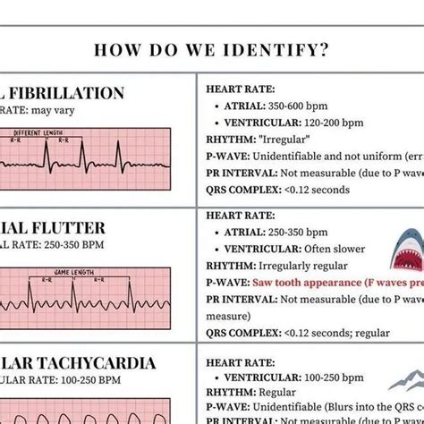 Ekg Rhythms Cheat Sheet