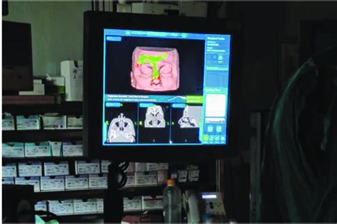 The Fusion Navigation System Used In The Preparation Stage Before The