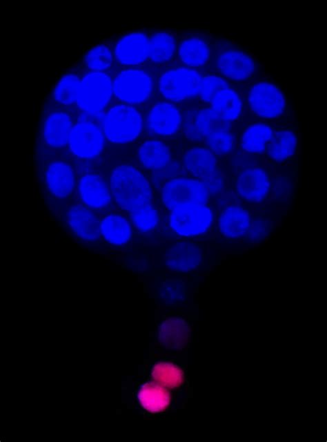 Plant Embryos Are Supported By A Temporary Organ Called A Suspensor