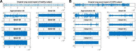 Wavelet Decomposition Of Lung Sound Signals Using Sym13 At 6th Level Download Scientific