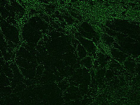 images not opening in jacop imagej researchgate