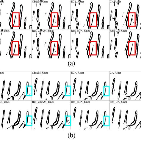 Vascular Segmentation Results Of Each Model Under Different Contrast