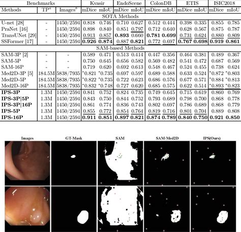 Promise Promptable Medical Image Segmentation Using Sam