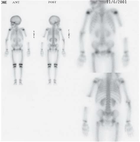 Nuclear Medicine Radiology Key