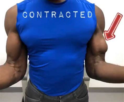 Exercise For Torn Bicep Muscle Bicep Tendonitis Treatment Duzns