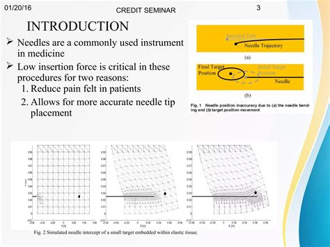 Fracture Mechanics PPT First Aid Injuries Fracture Mechanics PPT First Aid Injuries