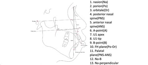 landmarks and reference lines used in cephalometric analysis download