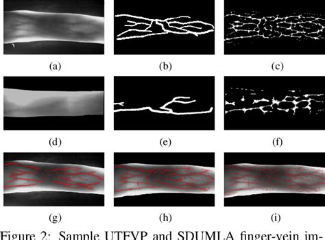 Table 1 From Finger Vein Recognition Using Deep Fully Convolutional Neural Semantic Segmentation
