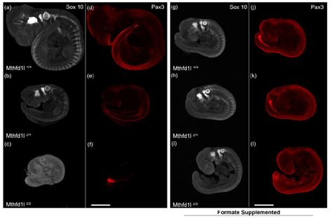 Mthfd1l Ablation Disrupts Neural Crest Cell Migration And Somitogenesis Download Scientific