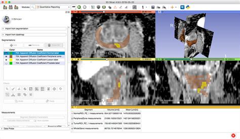 an example visualization of a single annotated image using 3d slicer