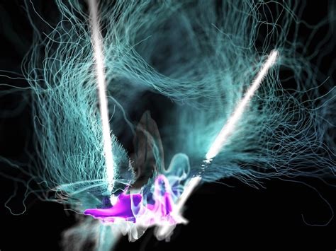 deep brain stimulation for spinal cord injuries ieee spectrum