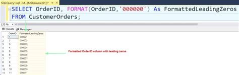 how to format numbers with leading zeros in sql server