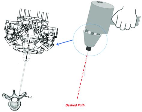 Schematic Of A Handheld Robot With Embedded Force Sensor Download Scientific Diagram