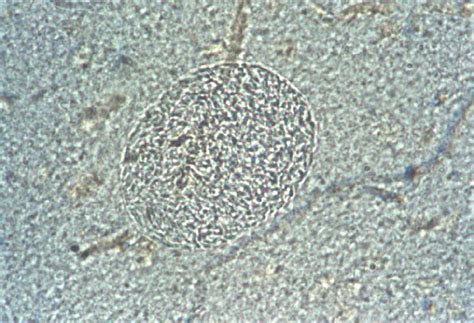Toxoplasma Gondii Tissue Cyst Isolated From Mice Brain 400 X