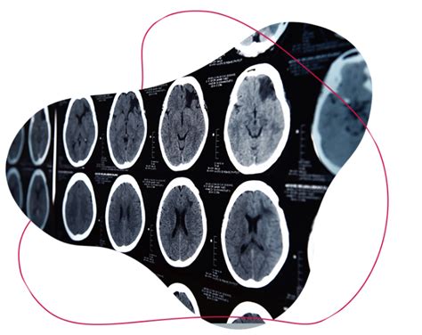 Graylight Imaging Medical Imaging Software