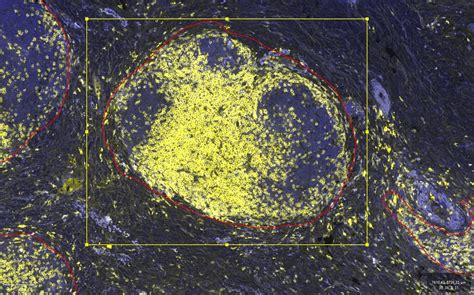 cell detection other than dapi on if image analysis image sc forum