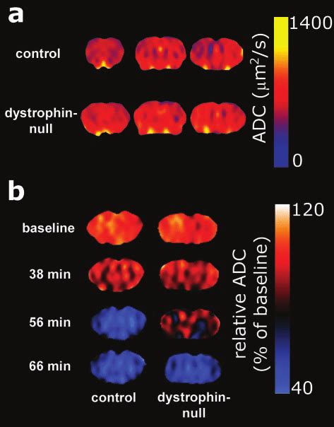 representative adc and relative adc maps of brains from g178 control