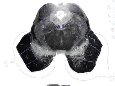 Midbrain Flashcards Quizlet