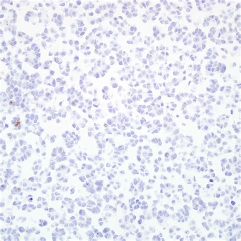 Cell Marque Hpv P16 Analyte Control