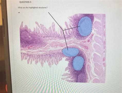 Solved What Are The Highlighted Structures