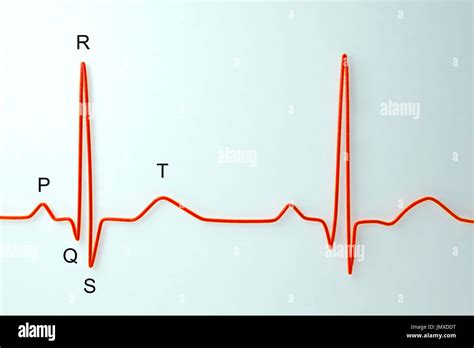 Normal Ecg High Resolution Stock Photography And Images Alamy
