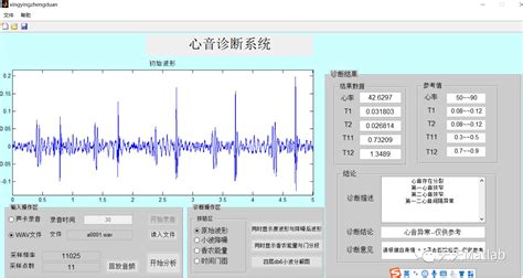 【心电信号】基于matlab实现心音诊断系统含gui 心音信号分析用什么软件 csdn博客