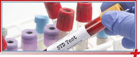 Confidential Std Testing Near Me In Leon Springs Tx
